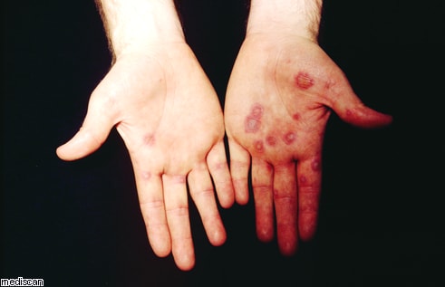 Drug-Induced Dermatologic Reactions: A Case History-Based Review