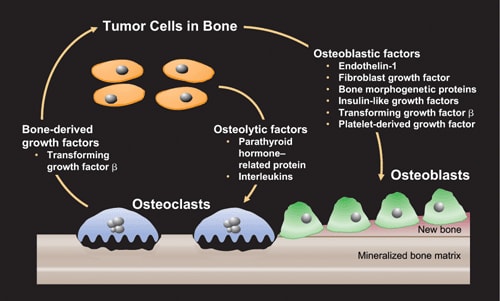 Skeletal Complications Across the Cancer Continuum: Bone Metastases and ...