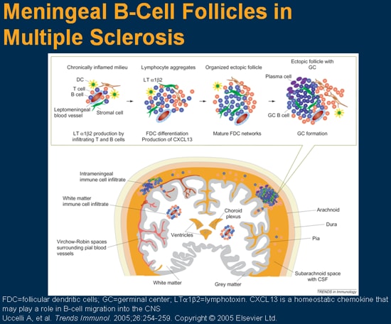 Investigating Multiple Sclerosis: Targeting Therapeutic Options