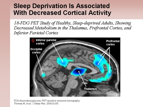 Recognizing and Managing Insomnia and Comorbid Conditions (Slides With ...