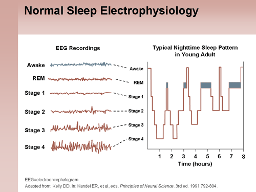 Recognizing And Managing Insomnia And Comorbid Conditions Slides With Transcript