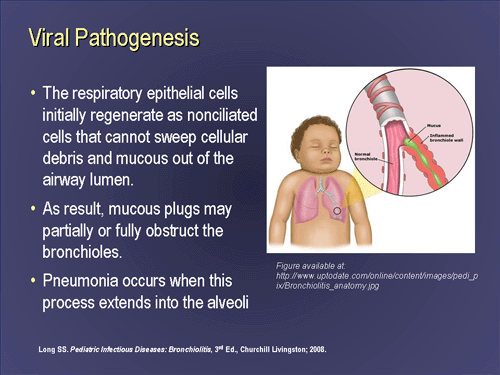 Management of Severe RSV Infections (Slides With Transcript)