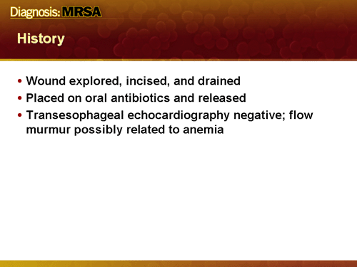 Intravenous Drug User (IVDU) (Slides With Transcript)