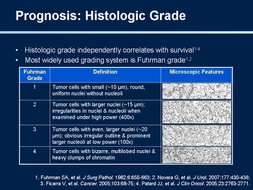 New Paradigms for Management of Unresectable/Recurrent RCC-Slide/Transcript
