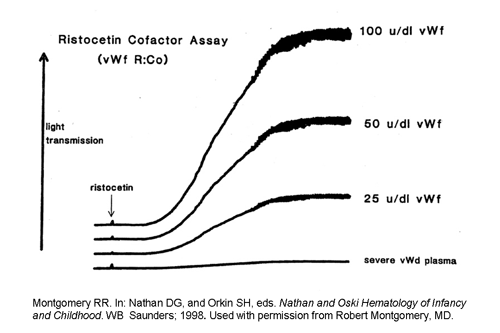 von Willebrand Disease-Pharmacist Role to Better Patient Outcome-Transcript