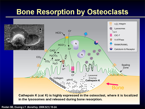 Cathepsin K Inhibitor: Unique Mechanism of Action--Osteoporosis--Transcript