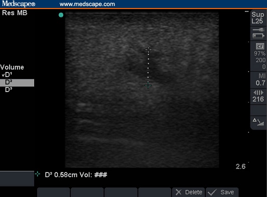 Highlights of PAS 2008