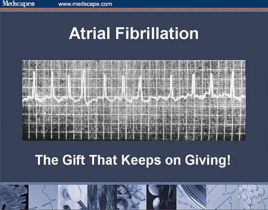 Atrial Fibrillation: The Scope of the Problem