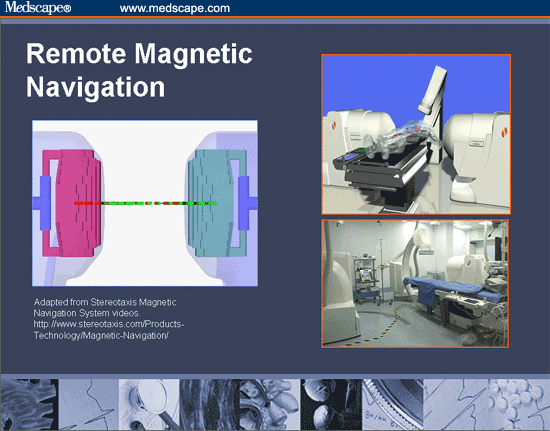 Atrial Fibrillation: What's New in Nonpharmacologic Therapy