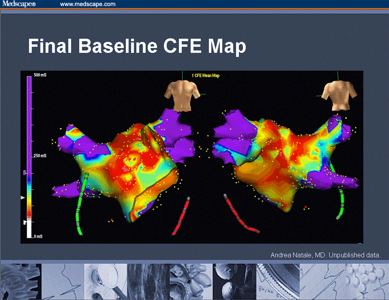 Atrial Fibrillation: What's New in Nonpharmacologic Therapy