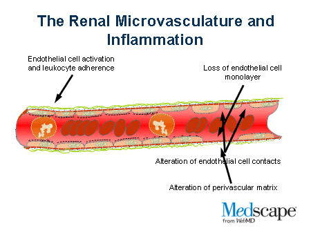 Microvascular Endothelial Cells: Controlling Inflammation in AKI