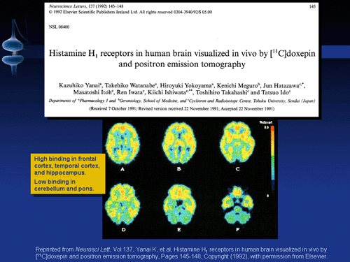 Histamine System Neurobiology: Key Regulator of Sleep-Wake Fx (Transcript)
