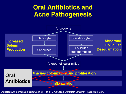 Advancements In Oral Antibiotic Therapy For The Treatment Of Moderate