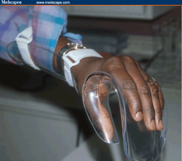 Spasticity: A Clinical Review