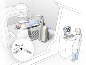 FDA Clears Body-Motion Device for Radiotherapy System