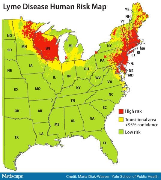 Lyme Disease Ticks Endemic in Northeast, Northern Midwest