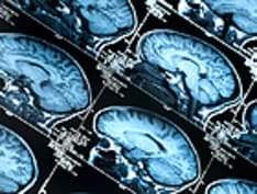 Adasuve (loxapine inhaled) dosing, indications, interactions, adverse ...