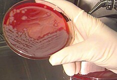 Biothrax (anthrax vaccine adsorbed) dosing, indications, interactions ...