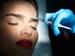 Botox May Help Bipolar Depression, Social Anxiety