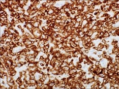 Istodax (romidepsin) dosing, indications, interactions, adverse effects ...