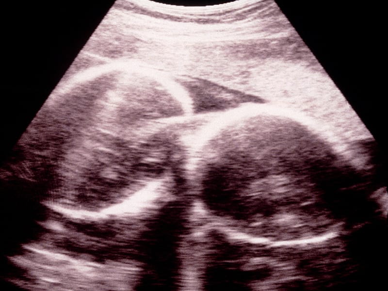 American Congress of Obstetricians and Gynecologists (ACOG) 2014 Annual ...