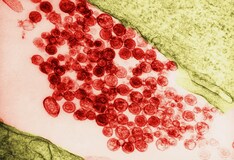 Human T-Cell Lymphotropic Viruses (HTLV) Treatment & Management ...