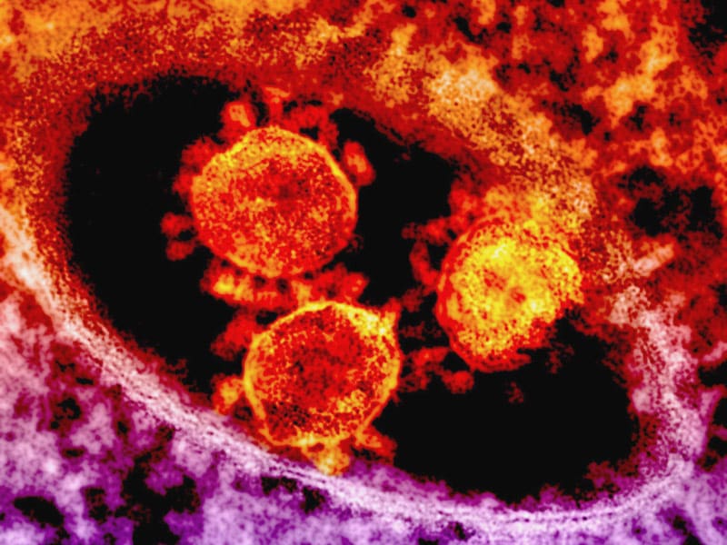 Special Report: MERS-CoV and the Risk to Healthcare Workers