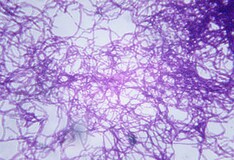 Biothrax (anthrax vaccine adsorbed) dosing, indications, interactions ...