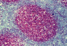 Zevalin (ibritumomab tiuxetan) dosing, indications, interactions ...