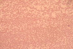 Neupogen, Granix (filgrastim, tbo-filgrastim, G-CSF) dosing ...