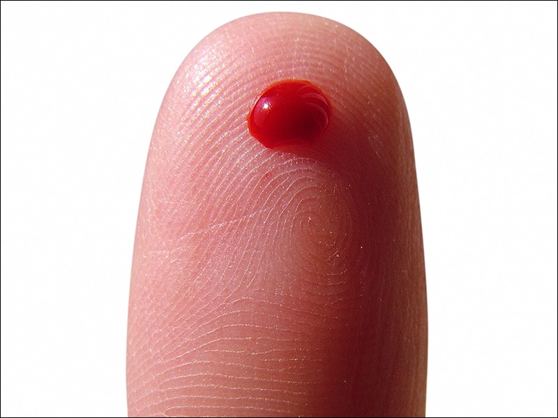 Society of Critical Care Medicine (SCCM) 44th Critical Care Congress