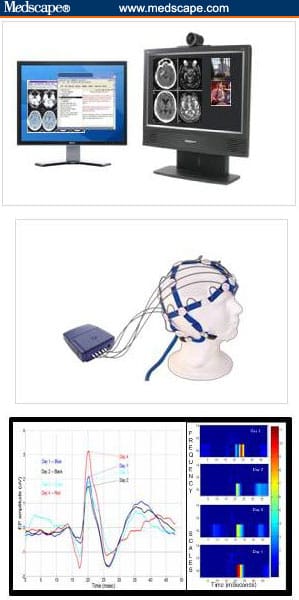 New EEG Technology Helps Assess Seizures in Urgent-Care Settings