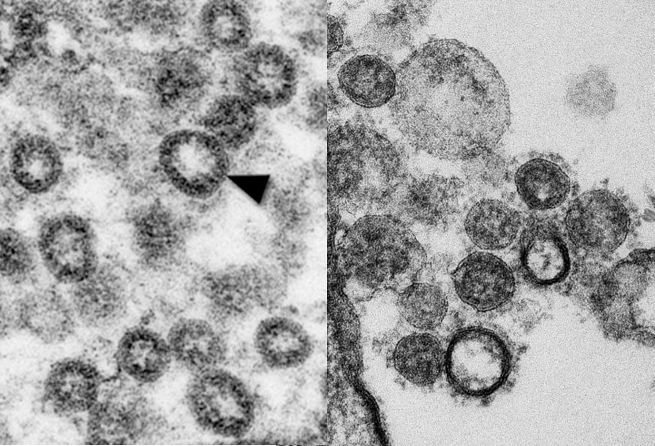 Coronavirus Disease 2019 (COVID-19): A Global Crisis