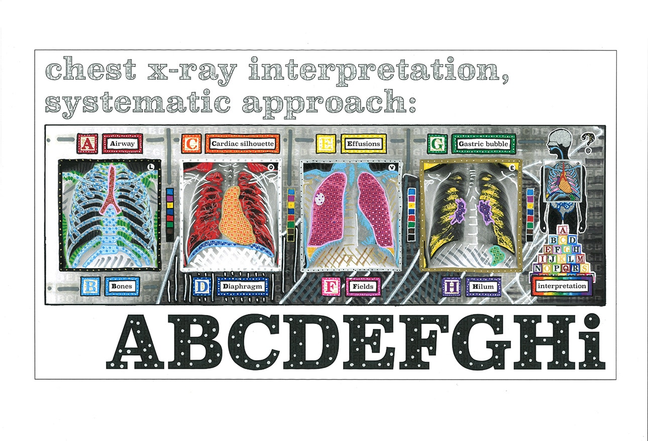 21 Clinical Mnemonics