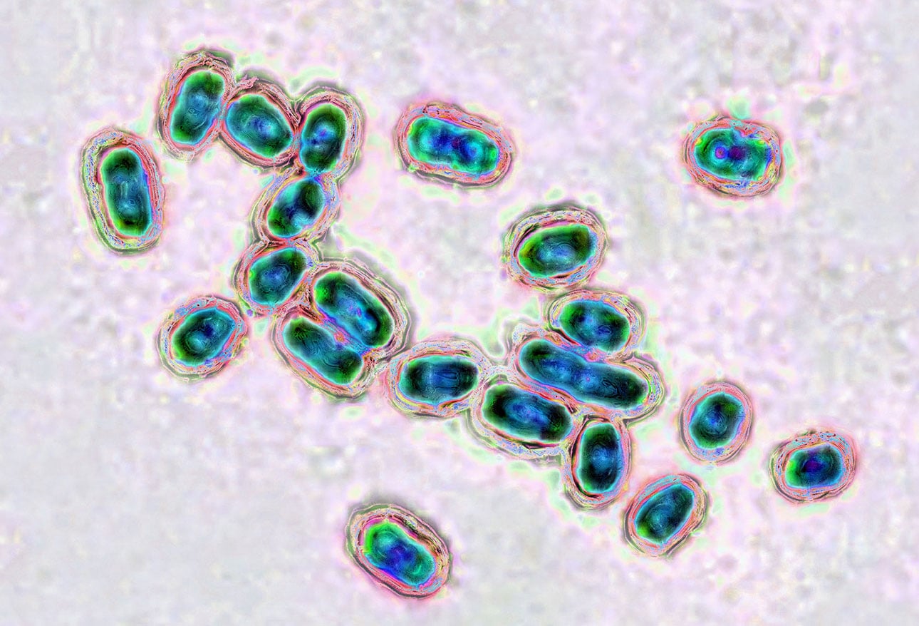Community-Acquired Infections: A Clinical Refresher to Diagnose, Treat ...