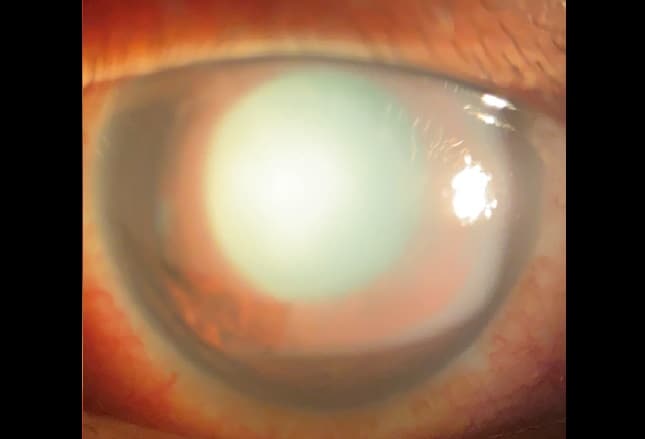 What the Eyes Tell You: 15 Abnormalities of the Lens