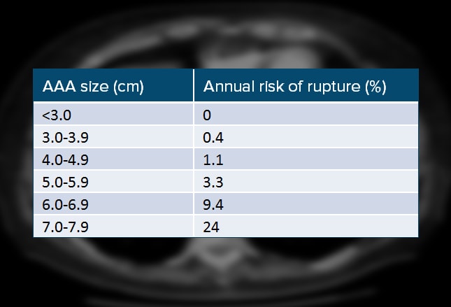 Abdominal Aortic Aneurysm: Has the Bubble Burst?