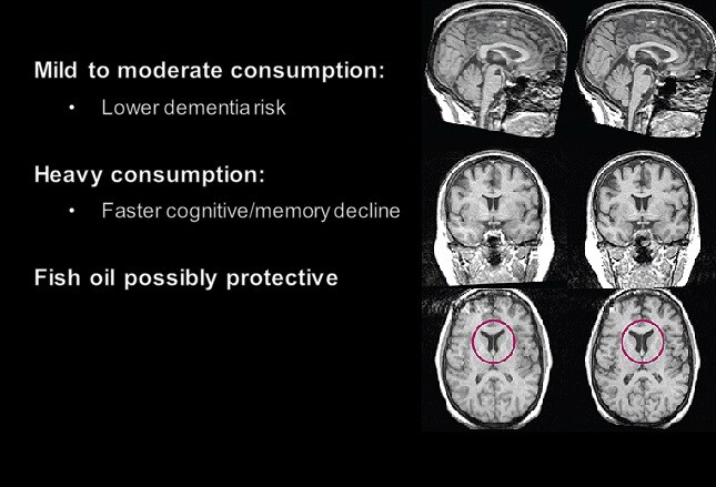 Alcohol and the Brain: Healthy or Harmful?