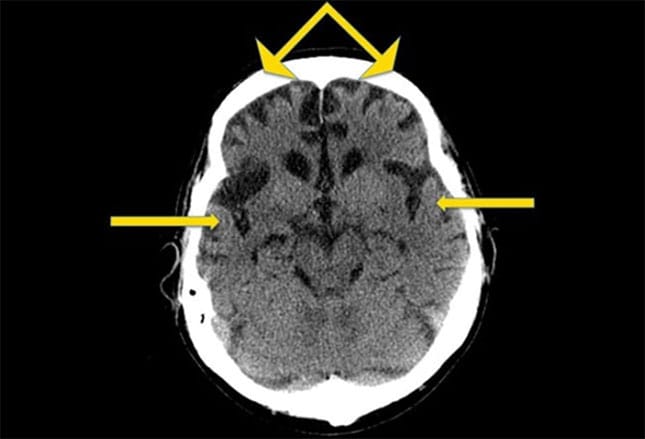 Alzheimer Disease Diagnosis and Care