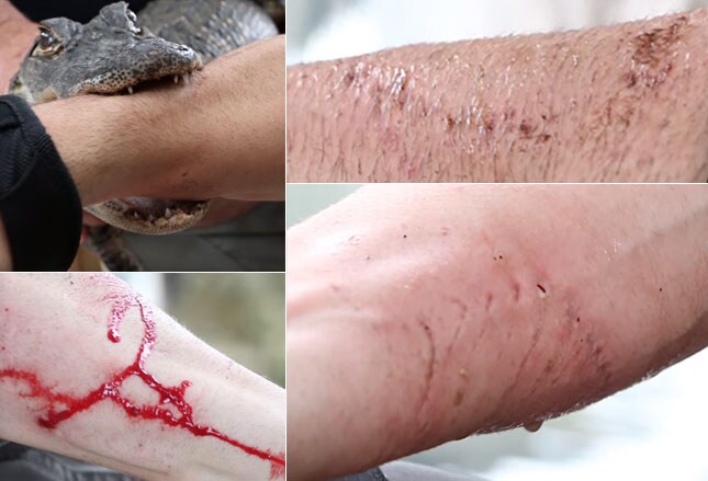 Animal Bites: What You Need to Know