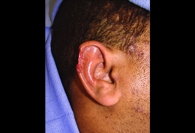 Animal Bites: What You Need to Know