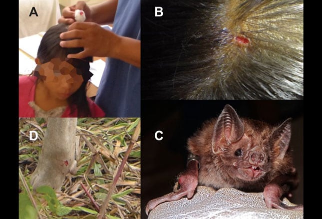 Animal Bites: What You Need to Know