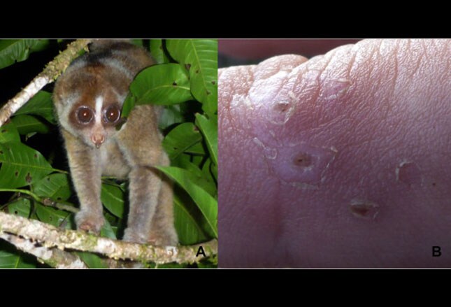 Animal Bites: What You Need to Know