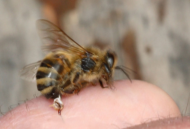 5 Arthropod Envenomations: From Benign Bites to Serious Stings