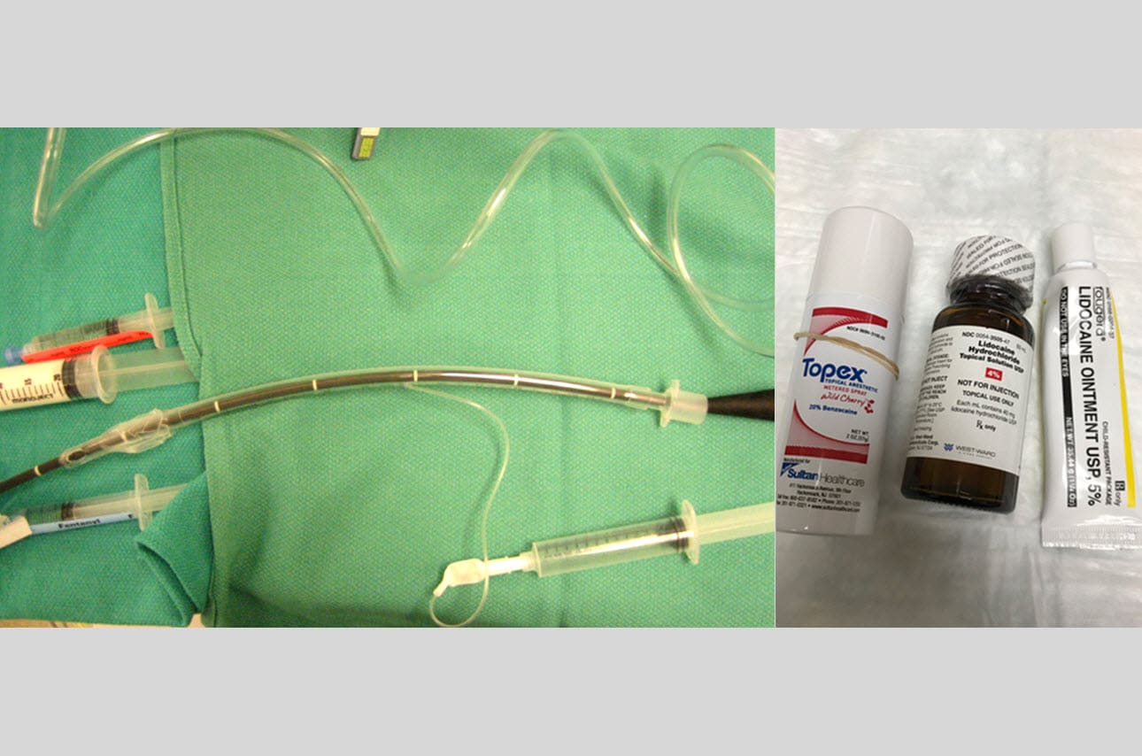 Awake Fiberoptic Intubation: Accessing the Airway