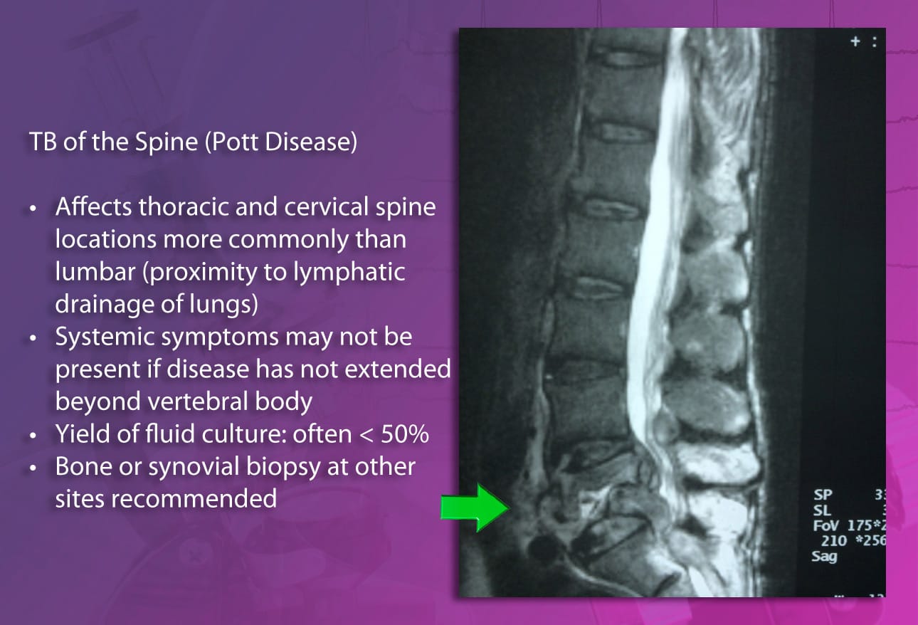Back Pain: The Latest in Diagnosis and Management