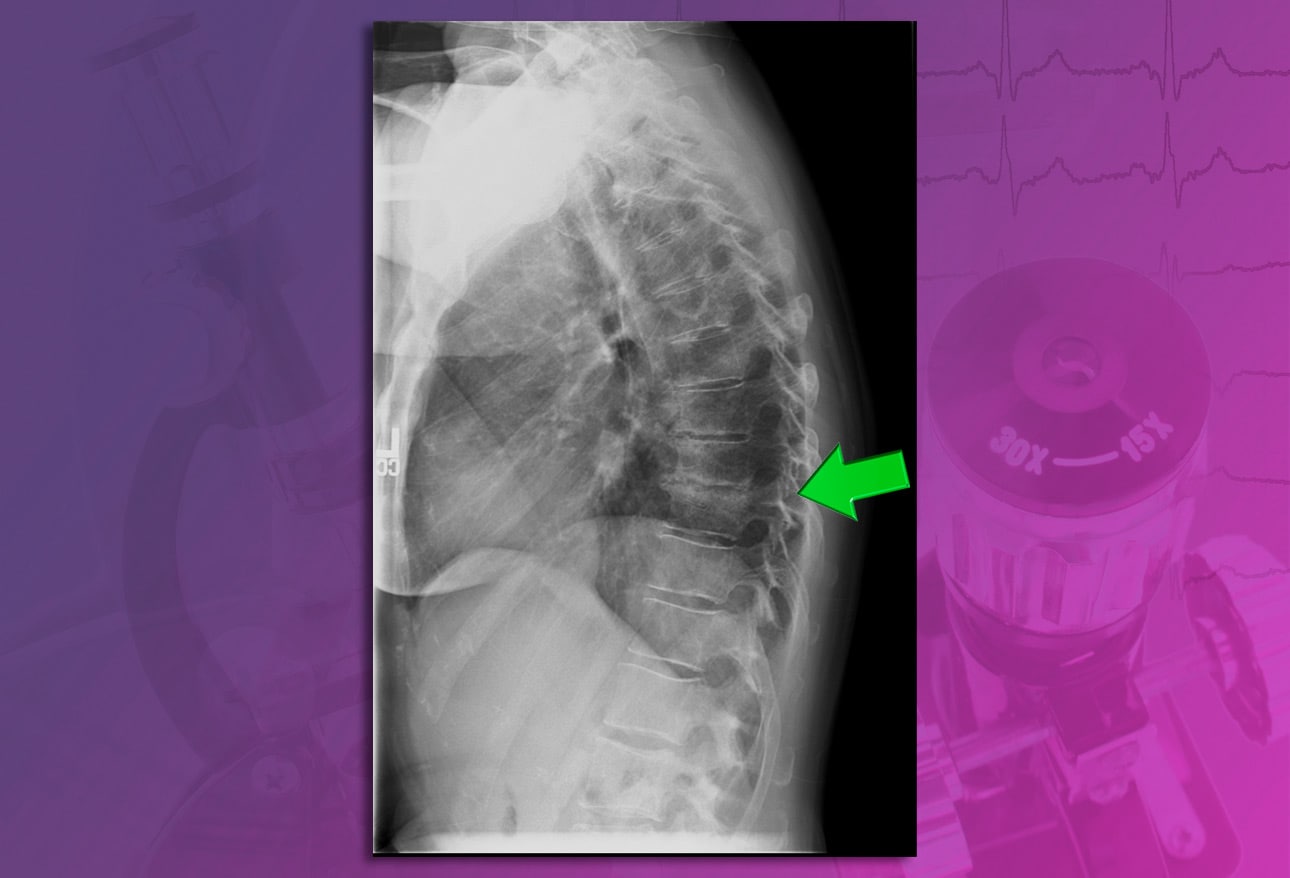 Back Pain: The Latest in Diagnosis and Management
