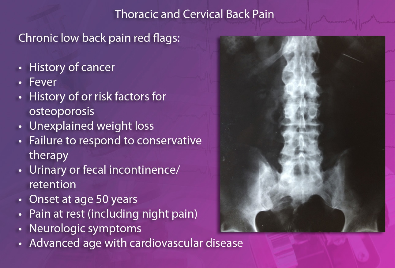 Back Pain: The Latest in Diagnosis and Management
