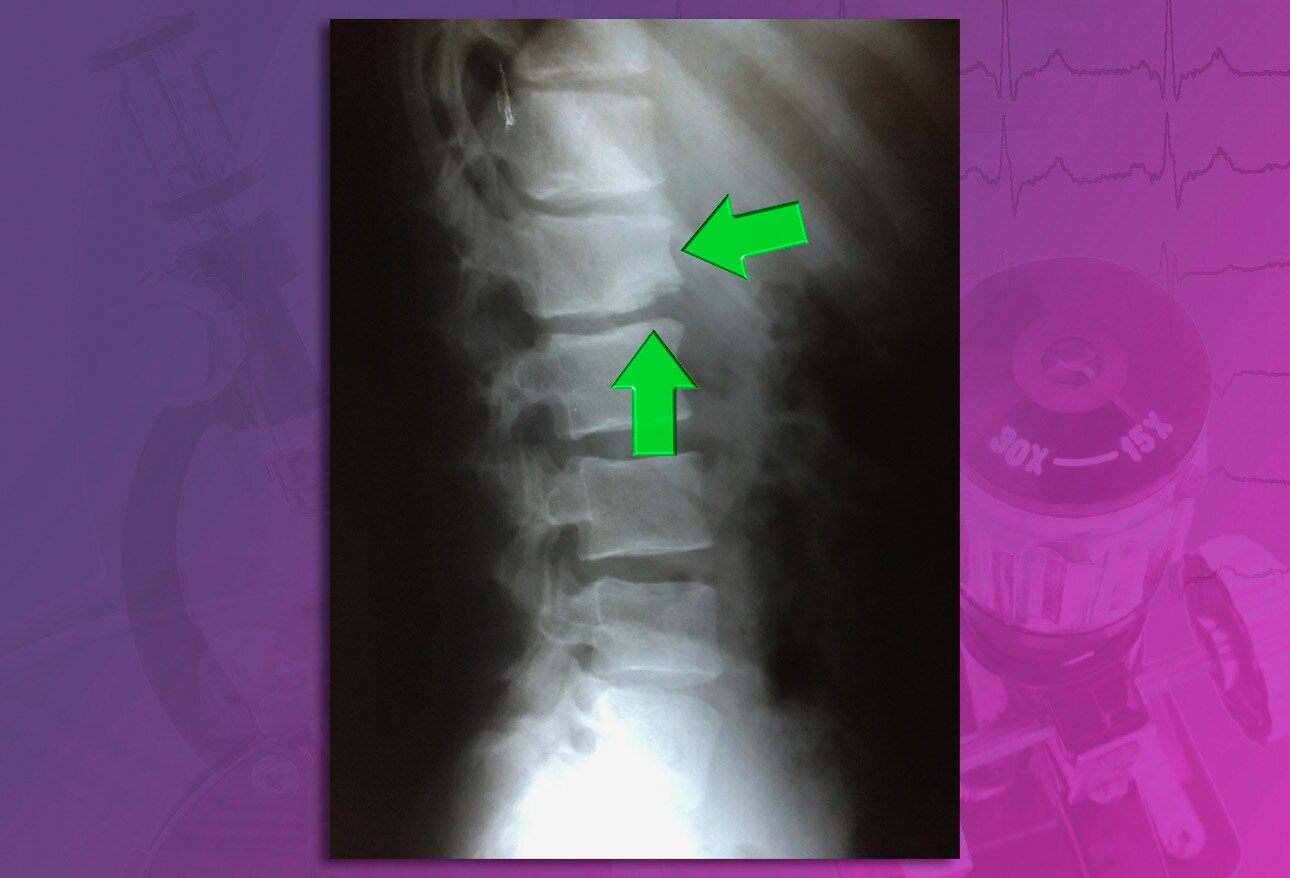 Back Pain: The Latest in Diagnosis and Management