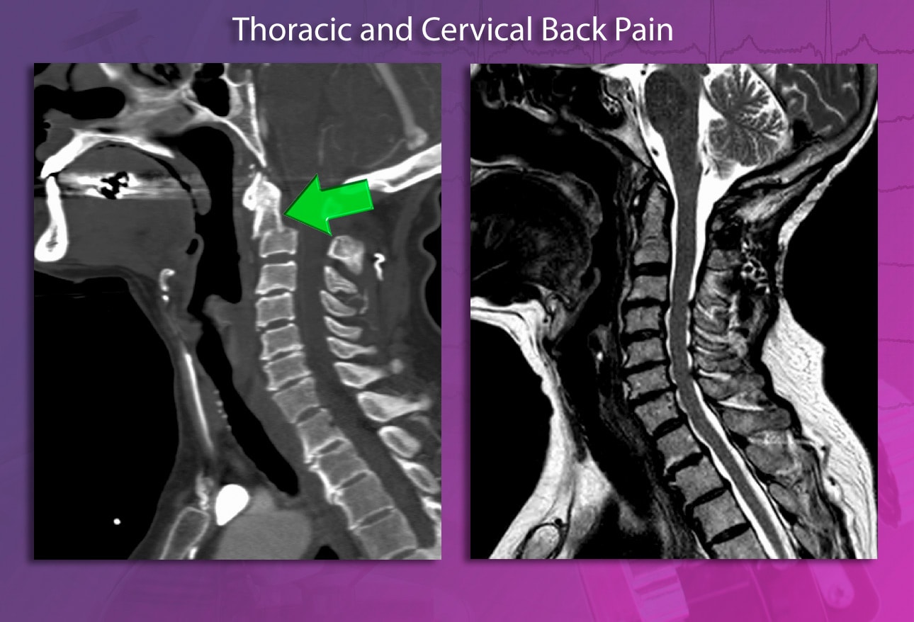 Back Pain: The Latest in Diagnosis and Management